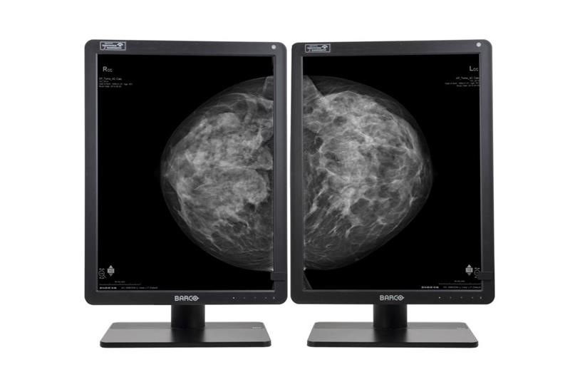 Barco Nio 5.8MP 21" Grayscale LCD Display with MXRT-6700 Controller ...